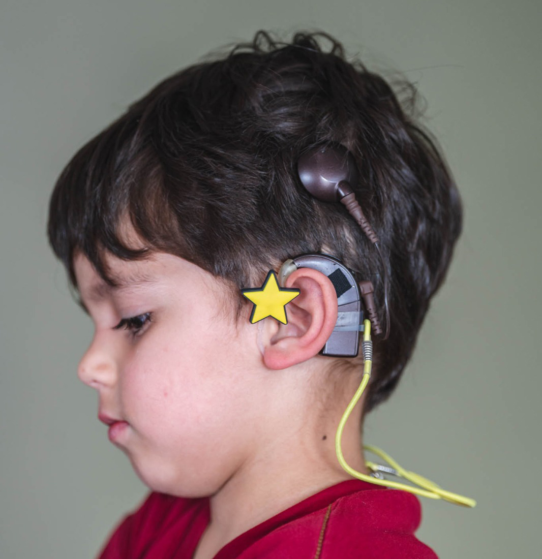 Especial Implante Coclear